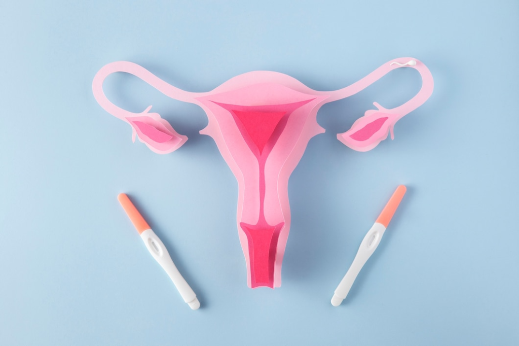 IUD Removal Missouri City TX - Sinang Health